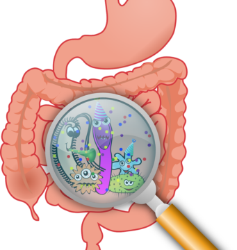 Fermented Vegetables at Home: A Step-by-Step Guide | FERMENTATIONS